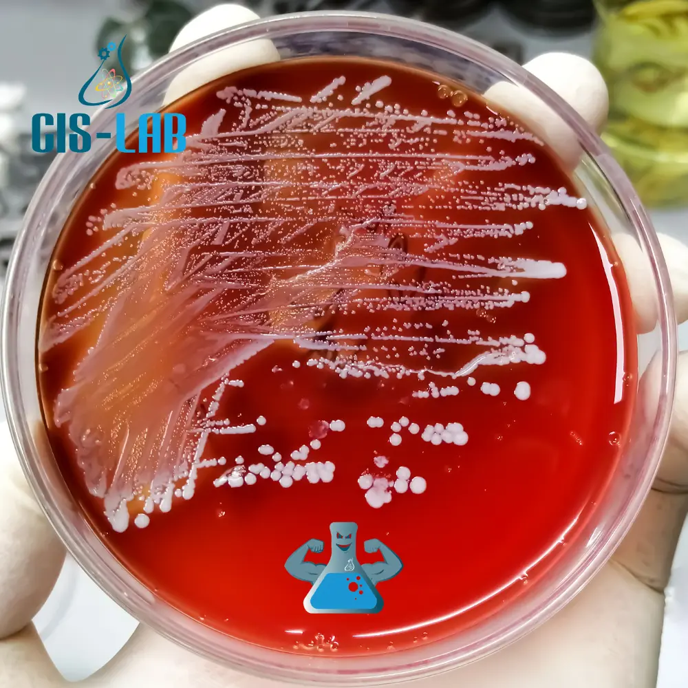 Cómo Cultivar Bacterias en Agar e Incubarlas: Procedimientos Certificados